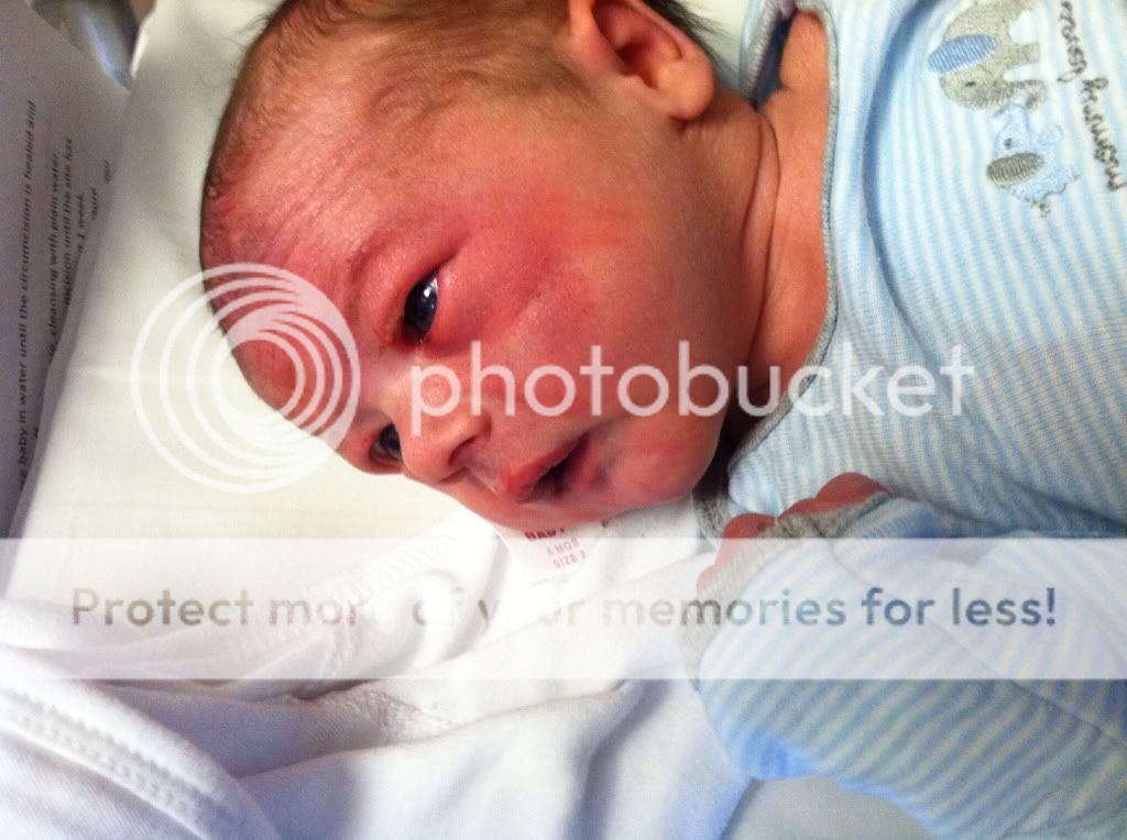 Brow presentation birth *lots of pics* :) | BabyCenter